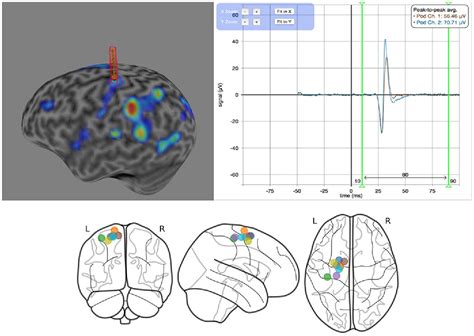 Figure 3 From The Role Of Dorsal Premotor Cortex In Resolving Abstract Motor Rules Converging