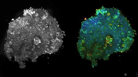 Dynamic Full Field Optical Coherence Tomography Aquyre Biosciences