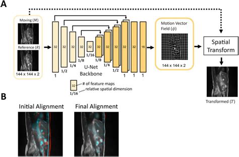 Fast Deformable Image Registration For Real Time Target Tracking During