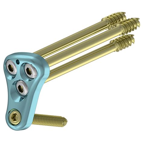 Orthopedic Implants Proximal Femoral Locking Plate Multiaxial