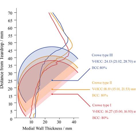 Plain Radiograph And 3 Dimensional Reconstruction Of Crowe Types I To Download Scientific