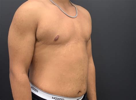 Gender Affirmation Form Face Body