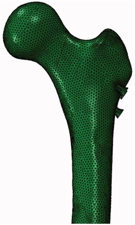 Mesh Generation In The Finite Element Model Download Scientific Diagram