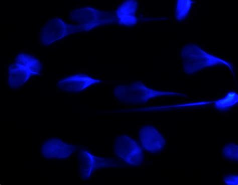 Troubleshooting For Streaky Dapi With Methanol Fixation Researchgate
