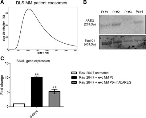 A Mm Patient Exosomes Size Distribution Was Determined By Dls Analysis