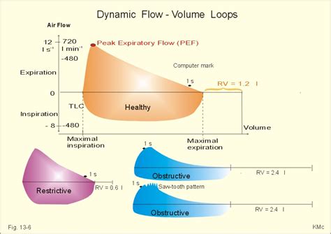 Respiratory Flow Volume