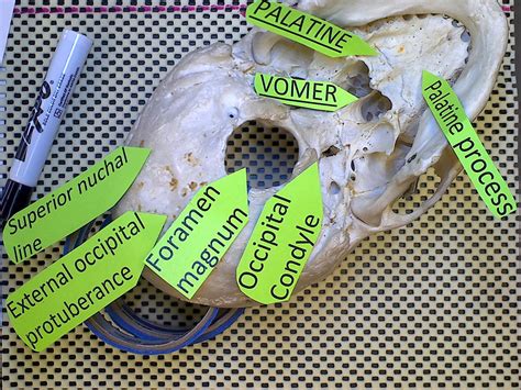 Unit Axial Skeleton Stagg High Babe Anatomy Physiology