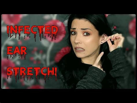 Infected Ear Gauges