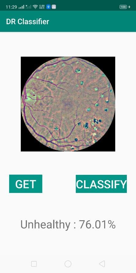 12 Prediction Result Of A Smartphone Based Diabetic Retinopathy