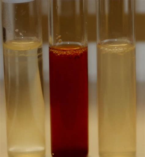Nitrate Reduction Test Its Principle Procedure And Results
