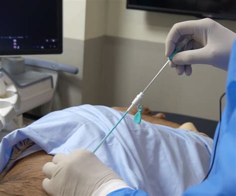 Uterine Fibroid Embolization Al Noor Diagnostic Centre