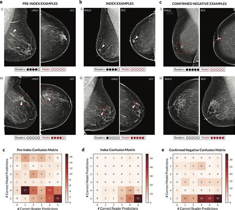 Robust Breast Cancer Detection In Mammography And Digital Breast Tomosynthesis Using An