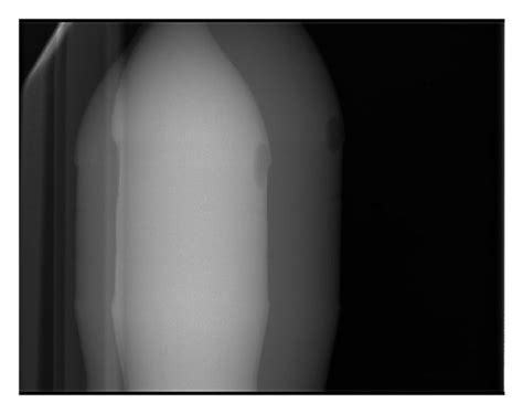 An Uncorrected Projection Is Shown In A B Shows The Intersection