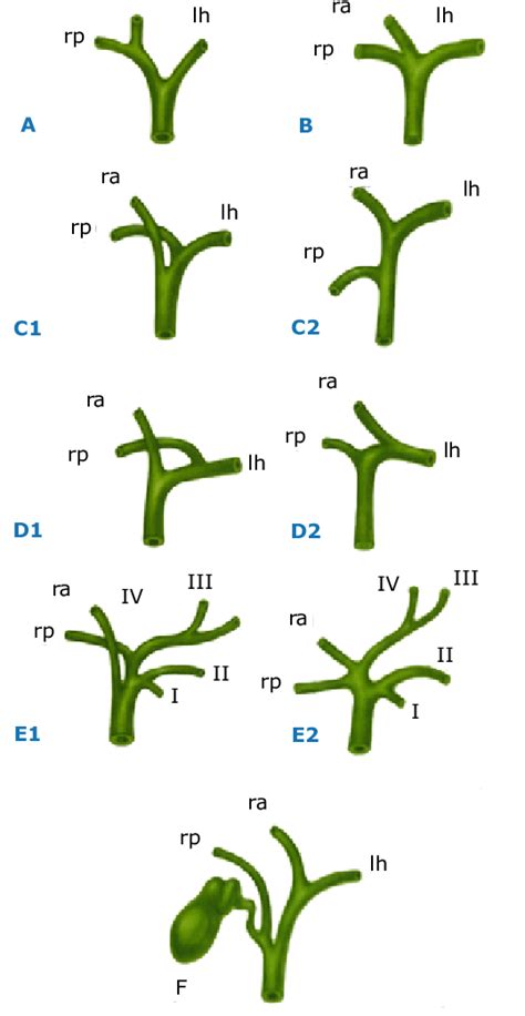 Main Variations Of The Hepatic Duct Confluence According To Blumgart Download Scientific