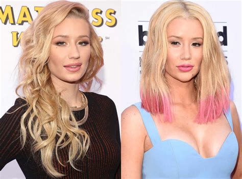 8 Celebrities Who Have Openly Admitted To Having Plastic Surgery
