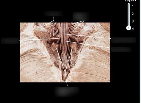 Bio 211 Lab Pal Human Cadaver Nervous System Slide 20 Diagram Quizlet