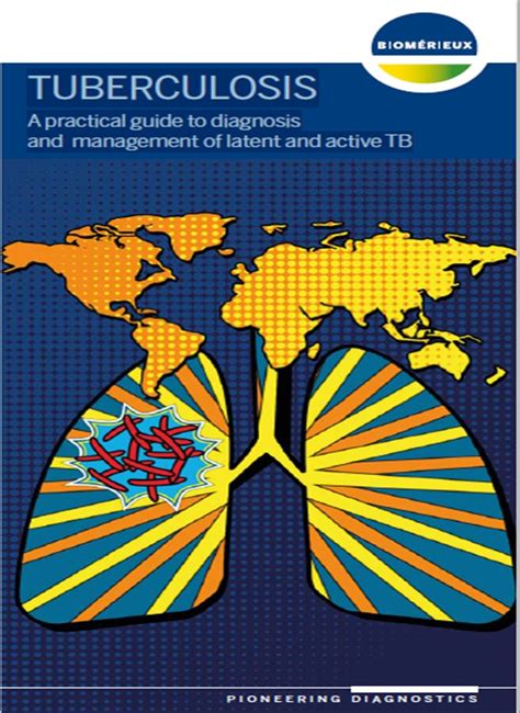 Tuberculosisa Practical Guide To Diagnosisand Management Of Latent And