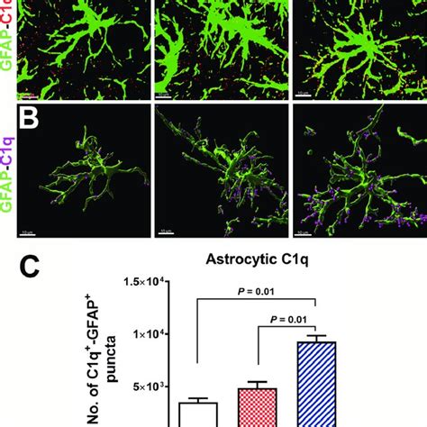 Elevated Astrocytic Expression Of Complement C Q In The Irradiated