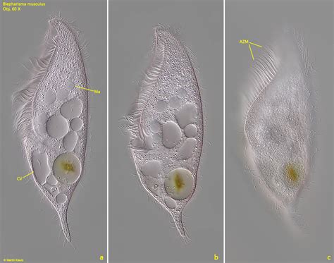Blepharisma Musculus Real Micro Life