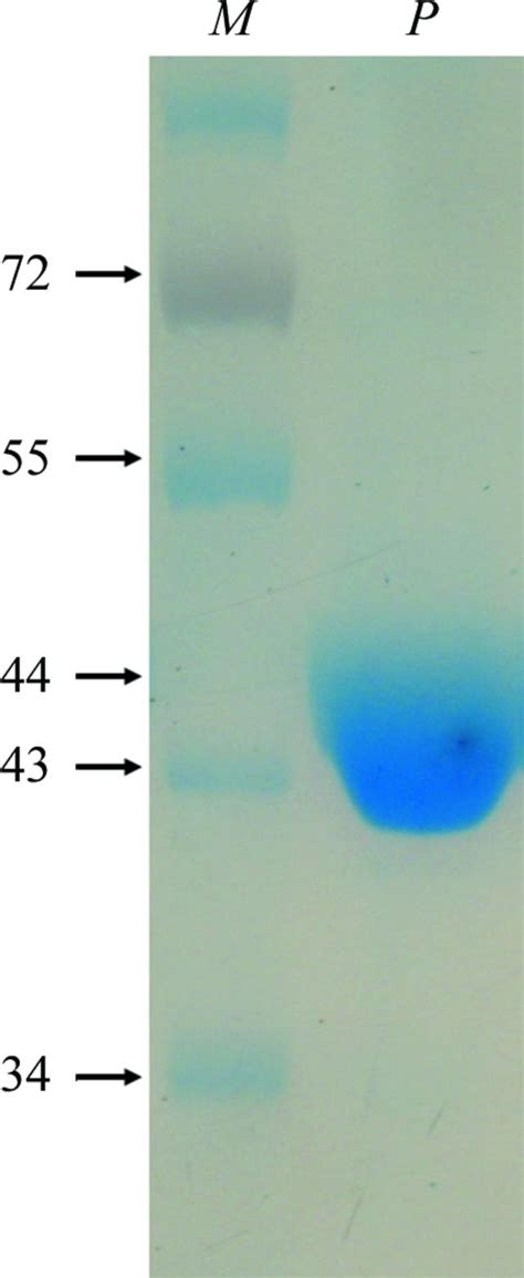IUCr Crystallization and preliminary X ray crystallographic analysis of β ketoacyl ACP