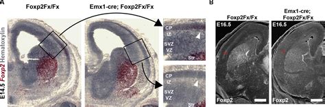 Figures And Data In Foxp2 Exhibits Projection Neuron Class Specific Expression But Is Not