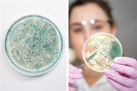 Bacterial And Fungal Identification