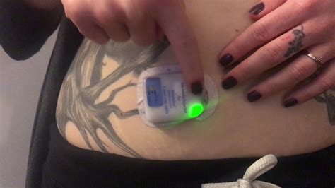 Can You Shower With Neulasta Patch At James Marts Blog