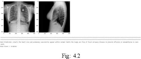 Figure 42 From Deep Learning Based Automatic Radiology Report Generation Semantic Scholar