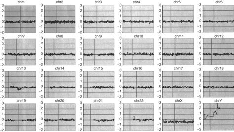 Cgha Profile Of Constitutional Dna From Patient Gos 115 The Individual