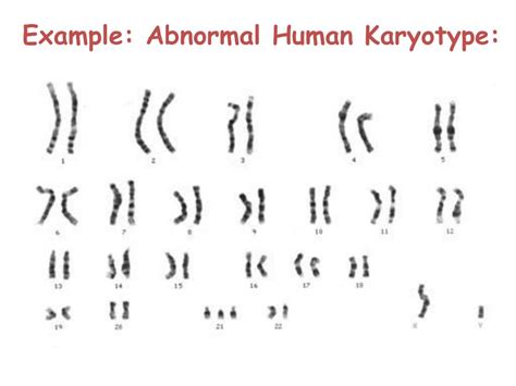 Ppt Karyotype Lab Powerpoint Presentation Free Download Id2284146