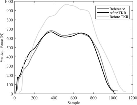 Assessment Of Human Gait After Total Knee Arthroplasty By Dynamic Time