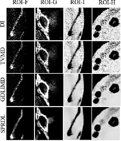Figure 1 From Spectral Ct Image Domain Material Decomposition Via