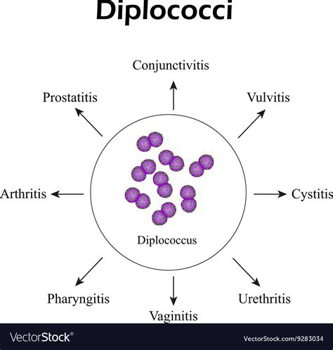 Diplococci The Disease Is Caused Diplococci Vector Image