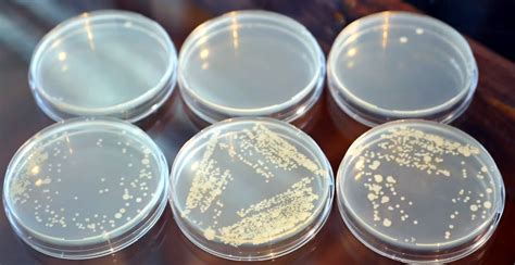 Washing Your Hands With 20 000 Volts 3d Print Errori Ed Esperienze