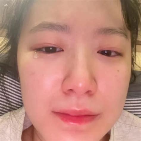 做种植牙后悔了？听听这些亲历者的感受 知乎