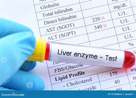 Enzyme Liver Range At Mark Bateman Blog
