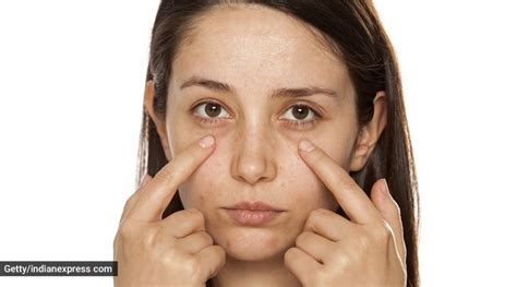 Natural Remedies To Get Rid Of Bags Under Eyes And Dark Circles Life Style News The Indian