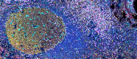 Queensland Spatial Biology Centre Wesley Research Institute