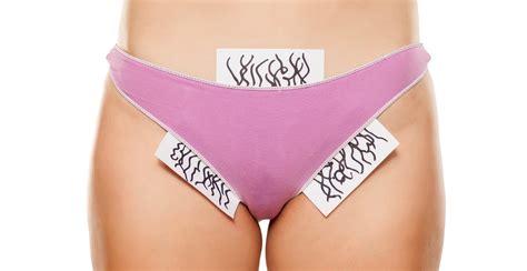 Ingrown Pubic Hair