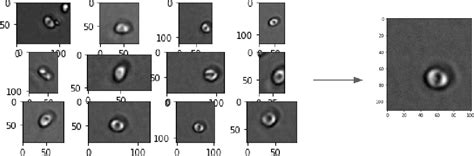 a novel deep learning based model for erythrocytes classification and