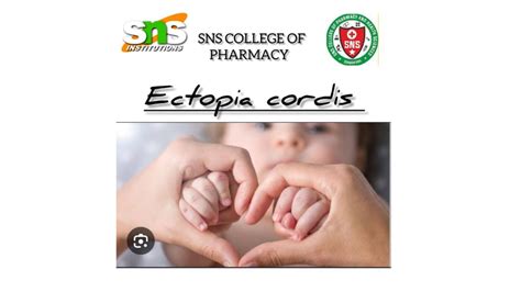 Ectopia Cordis