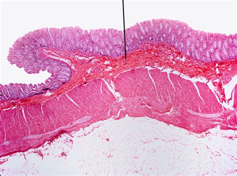 Digestive System Large Intestine Histology Diagram Quizlet