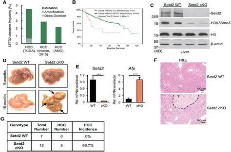 Early Cholangiocarcinoma Detection With Magnetic Resonance I