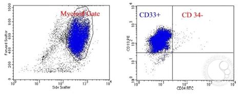 Chronic Myelogenous Leukemia 11