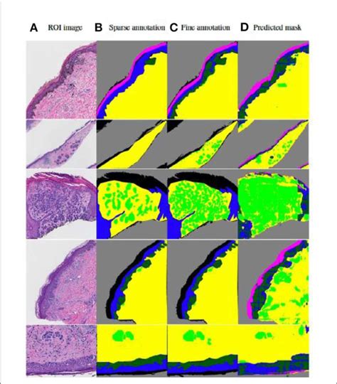 Sualization Of Results By Our Published Two Step Segmentation Method Download Scientific