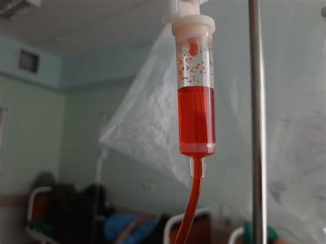 Gotero Con Quimioterapia Roja Doxorrubicina Foto De Stock Y Más Banco