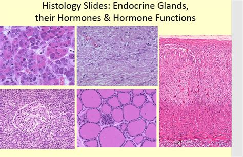 Solved Histology Slides Endocrine Glands Their Hormones And