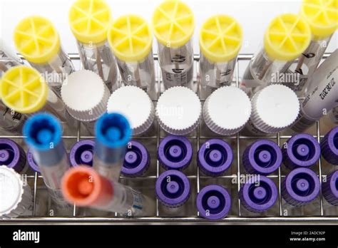 Microbial Sample Transport Swabs And Tubes These Standard Containers Are Used To Securely And