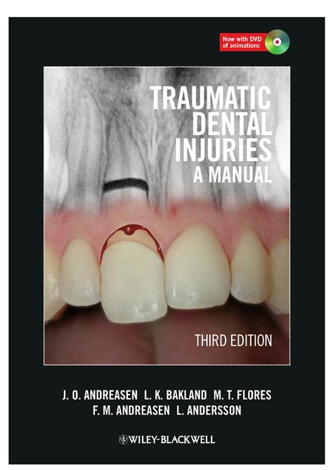 Solution Tramatic Dental Injuries A Manual Studypool