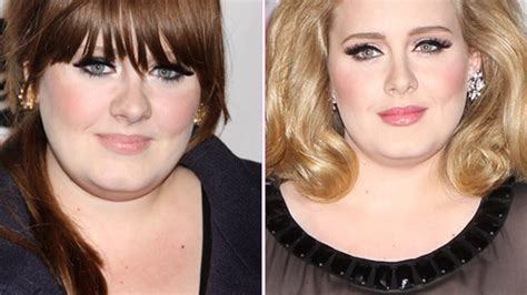 Adele Nose Job — Plastic Surgeons Confirm Adele Plastic Surgery Rumors